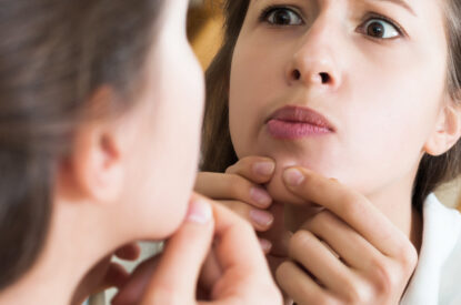The primal appeal of pimple-popping videos: Our obsession with gross ...