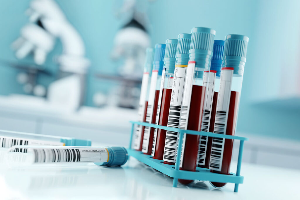What do your blood test results mean? A toxicologist explains the ...