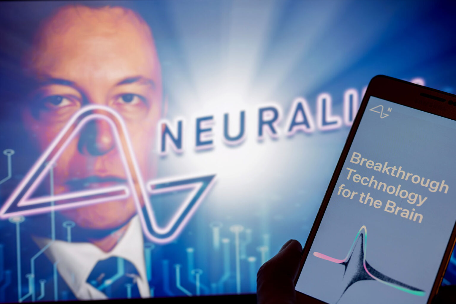 The FDA finally approved Elon Musk’s Neuralink chip for human trials ...