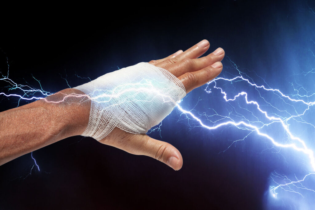 Electricity beats time when it comes to healing wounds, research finds ...
