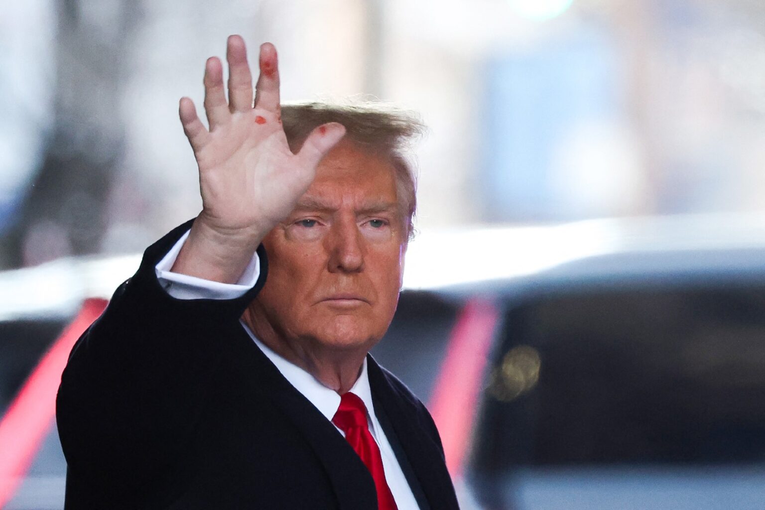 Trump adds to the mystery of those red spots on his hand — "Maybe it's ...