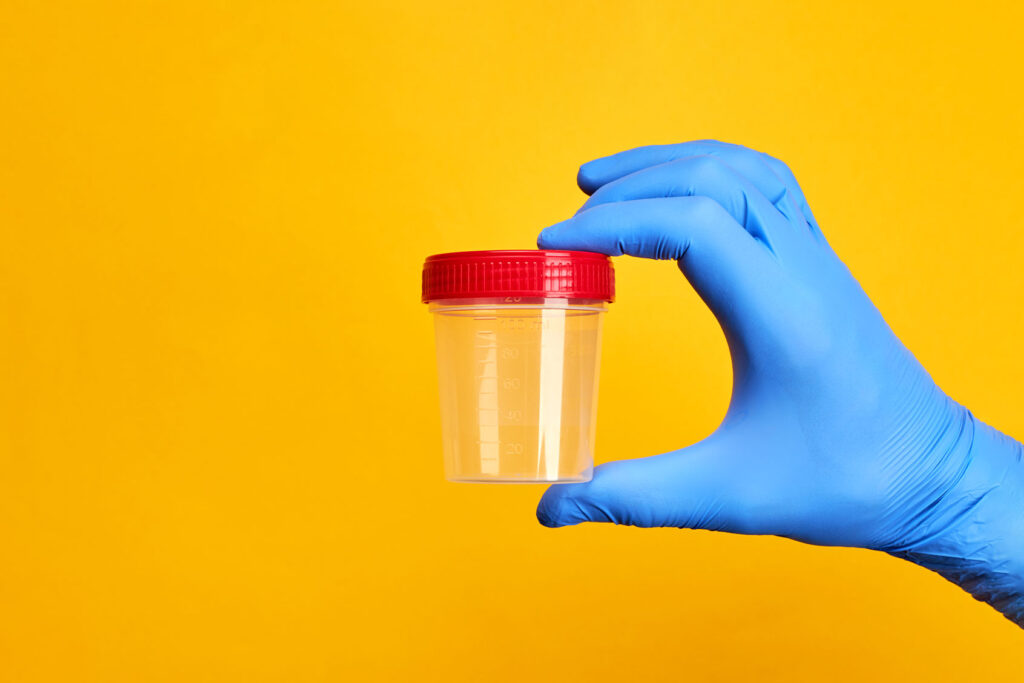 Scientists solve mystery behind why pee is yellow - Salon.com